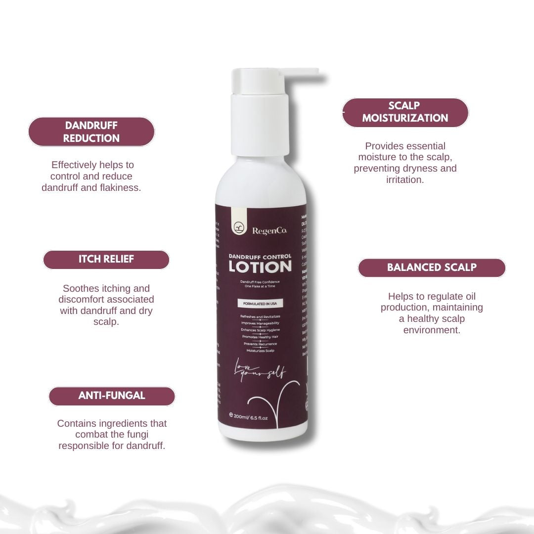 RegenCo Dandruff Control Lotion- 200ml | Promotes Healthy Hair Moistur ...